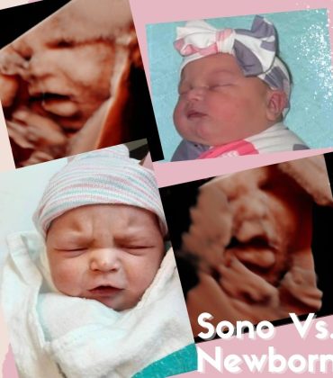 Newborn Vs. Ultrasound - Peeping Moms Ultrasound Boutique